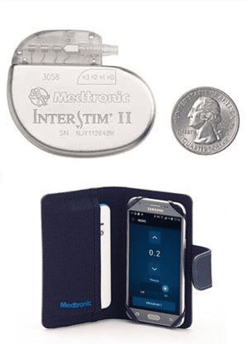 Medtronic Bowel Control Therapies | Williamson Health